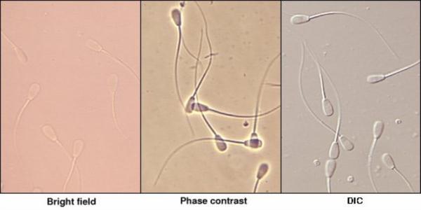 Semen Testing | Capontree Vets